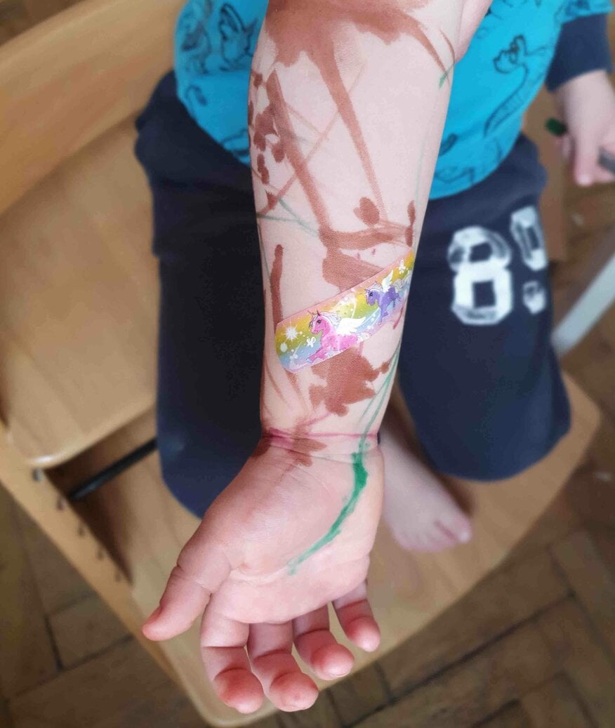 Juckende Pickel Nach Tattoos Ein Tiefer Stich Ins Herz Des Darms Die