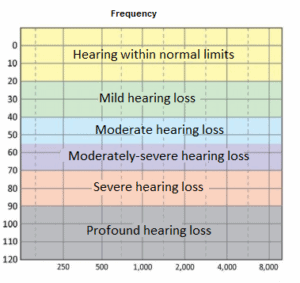How to Read Your Hearing Test Results: The Audiogram