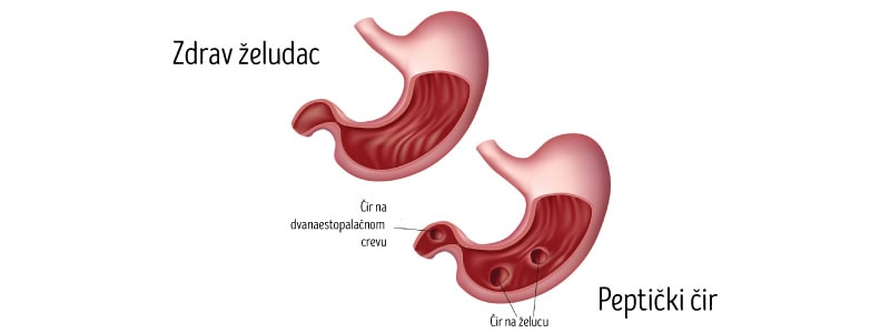REFALGIN tablete protiv gastroezofagealnog refluksa i gorušice - Dr ...