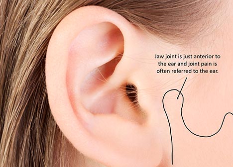 TMJ earaches | It can be a sign of a more serious condition