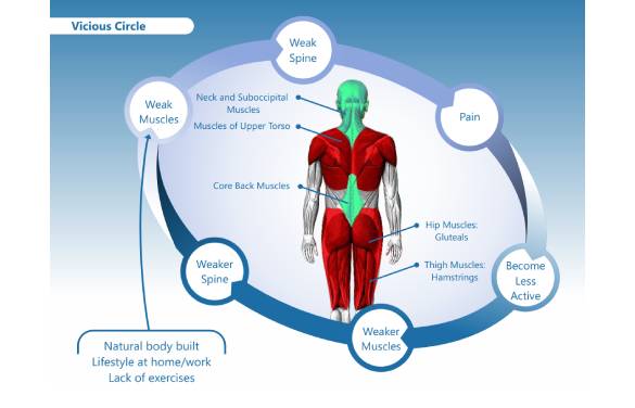 Neck pain treatment - Neck pain treatment clinic in gurgaon