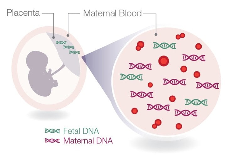 Blood Test To Determine Gender Of The Baby? Why Not?