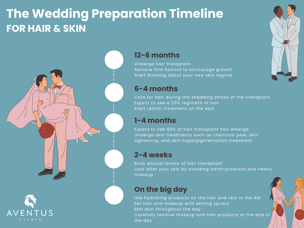 Preparation Before Wedding 5 Things You Might Want To Add To Your