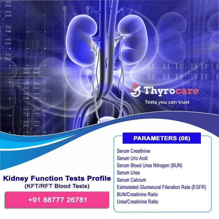 Kidney/Renal (KFT/RFT) Test in Jamshedpur - Best Price & Lab