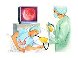 Endoscopy vs Gastroscopy: Understanding the Difference - Meducination