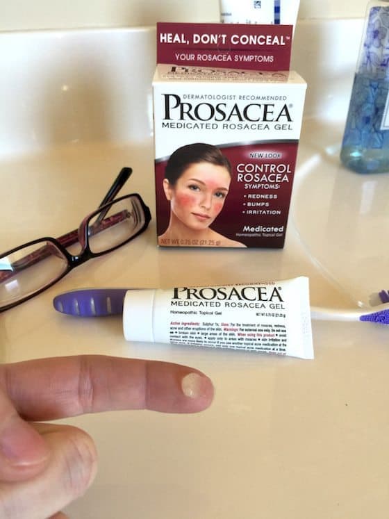 How Prosacea Helps Control My Rosacea Symptoms + Giveaway - Saving You ...