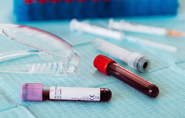 Plasmapheresis: How This Life-saving Procedure Helps With Severe Viral ...