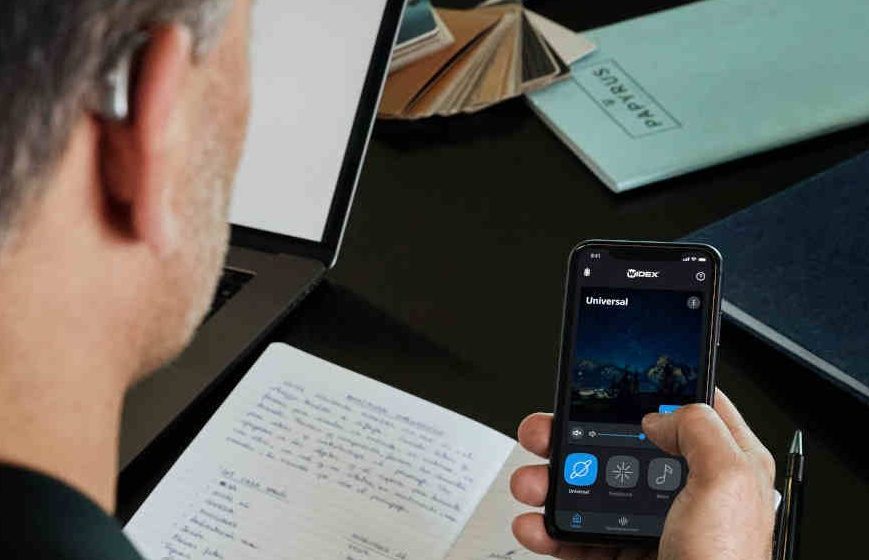 Widex SmartRIC 330 On Sale | Price & Reviews| FitHearing