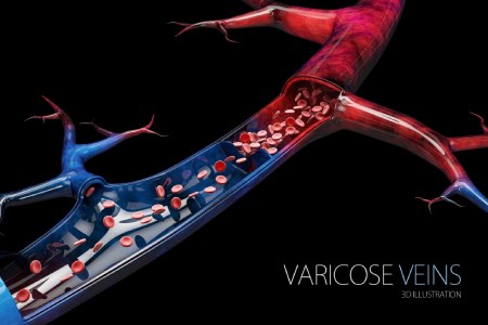 Podiatrist in Boca Raton & Boynton Beach - Foot, Ankle & Leg Vein Center