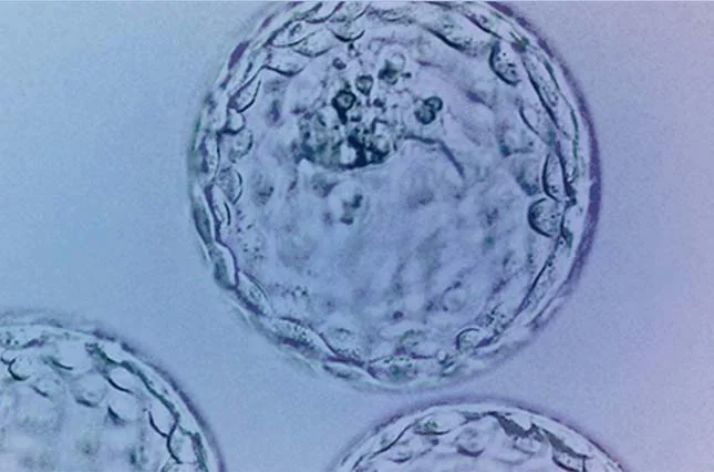 Embryo Transfer - CooperSurgical