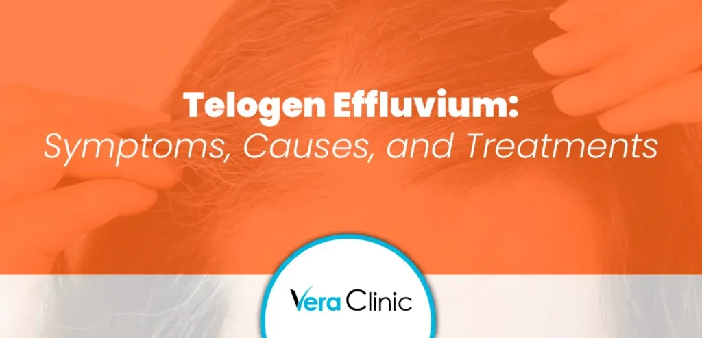 Telogen Effluvium: Symptoms, Causes, and Treatments - Vera Clinic