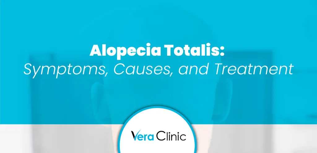 Alopecia Totalis: Symptoms, Causes, and Treatment - Vera Clinic