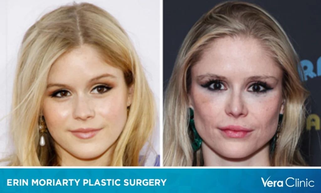 erin moriarty hot face