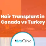 Male BBL: Understanding the Male Brazilian Butt Lift