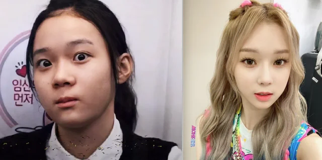 K-Pop Plastic Surgery: Unveiling the Transformations of K-Pop Idols