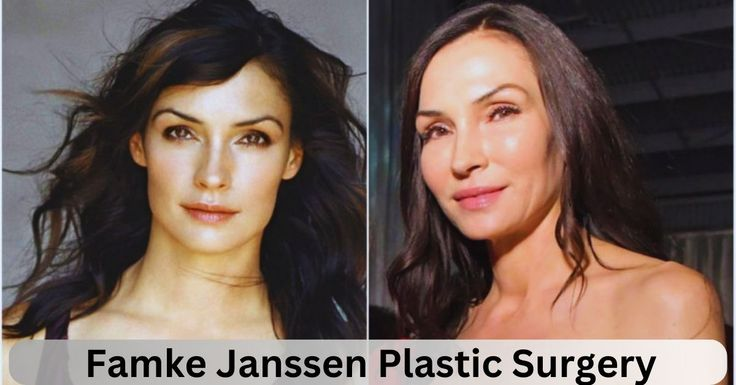 Famke Janssen Plastic Surgery: Learn Only The Facts