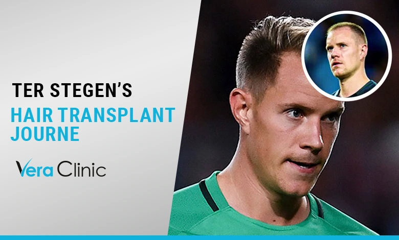 Marc-André Ter Stegen’s Hair Transplant - Vera Clinic