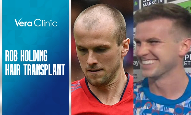 Rob Holding Hair Transplant - Vera Clinic