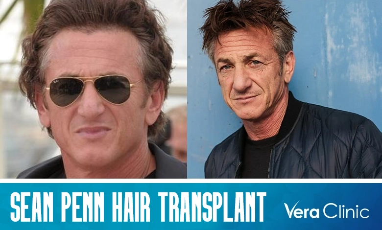 Sean Penn Hair Transplant (Speculation and Styling)
