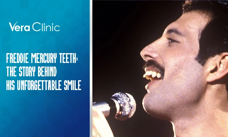 Freddie Mercury Teeth: The Story Behind His Unforgettable Smile
