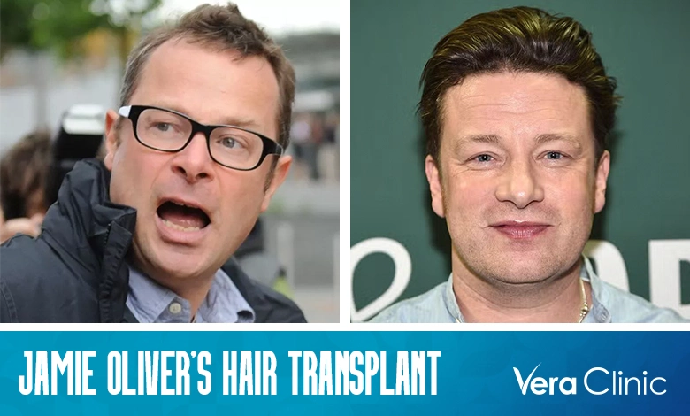 Jamie Oliver Hair Transformation