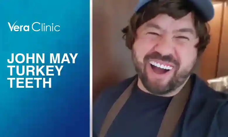 John May Turkey Teeth: An Instagram Star from Liverpool