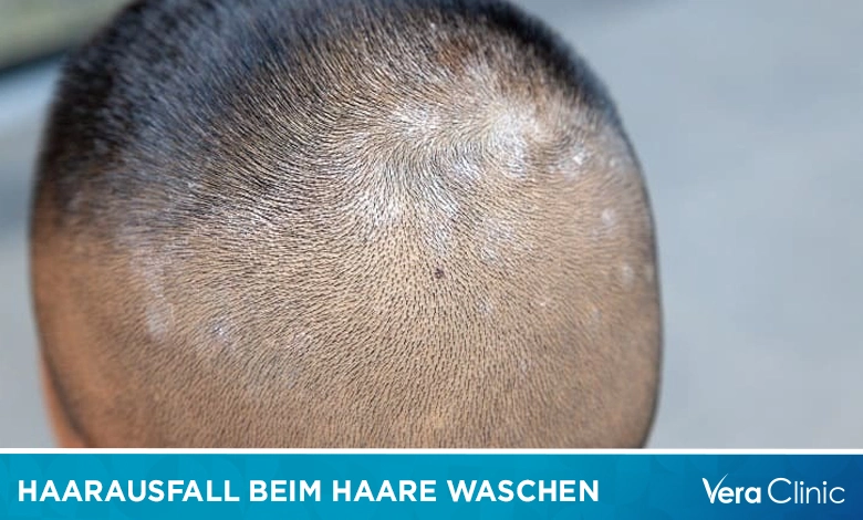 Haarausfall beim Haare waschen: Ursachen, Symptome und ...
