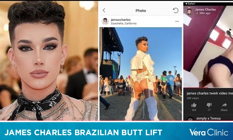 James Charles Brazilian Butt Lift: Exploring the Controversy