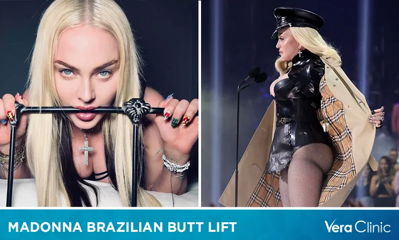 Madonna Brazilian Butt Lift: An Exploration of Plastic Surgery
