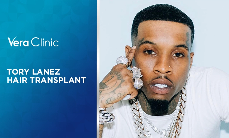 Tory Lanez Hair Transplant