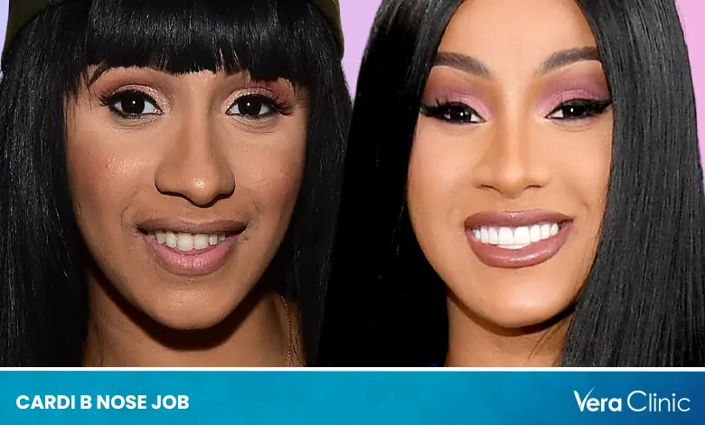 Cardi B Nose Job: A New Look Alongside Musical Journey