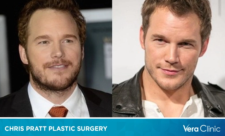 Chris Pratt Plastic Surgeries, Before and After