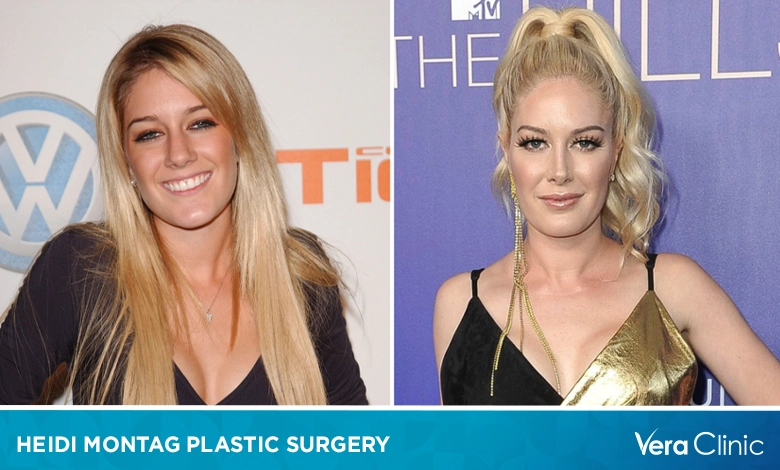 Heidi Montag Plastic Surgery: A Transformation Journey