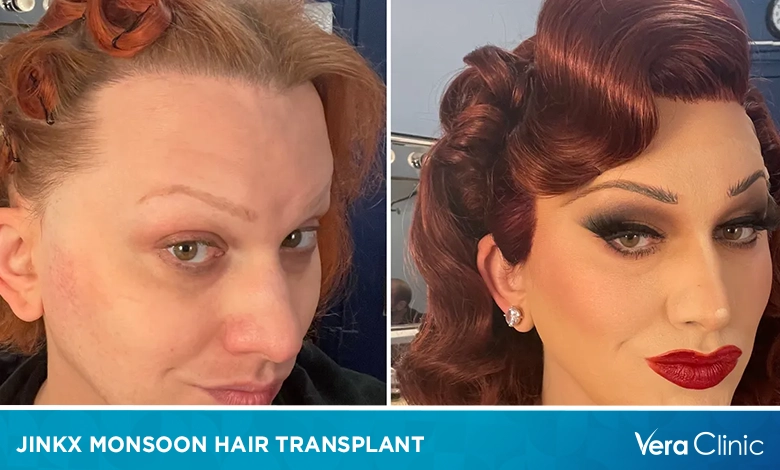 Jinkx Monsoon Hair Transformation