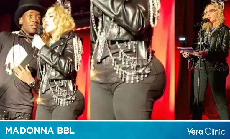 Madonna BBL: Everything About Rumors