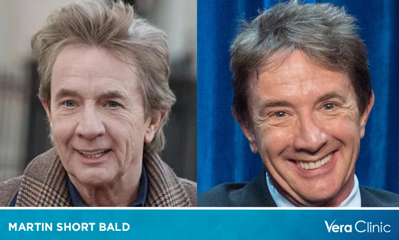 Martin Short Hair Transformation
