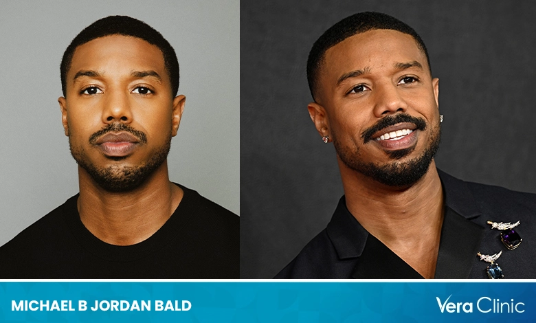 Michael B. Jordan Bald Look and Redefining Hair Trends