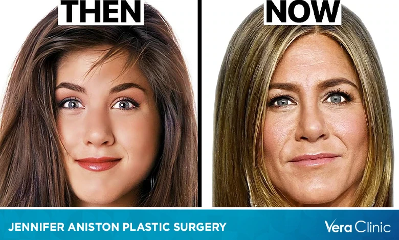 adele silva plastic surgery