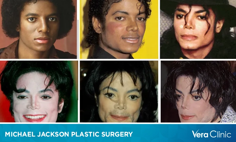 Michael Jackson Plastic Surgeries, Before and After