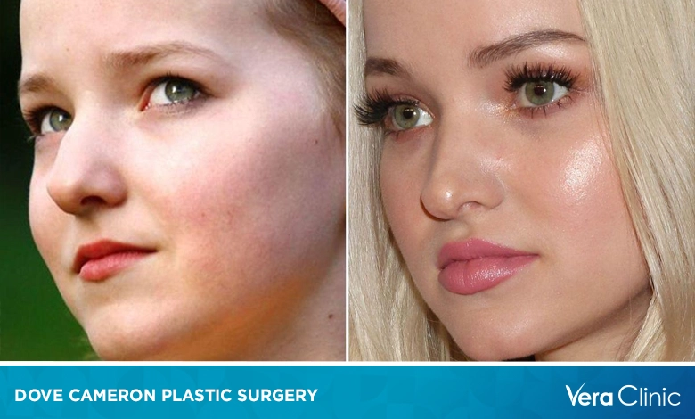 Dove Cameron Plastic Surgeries, Before and After