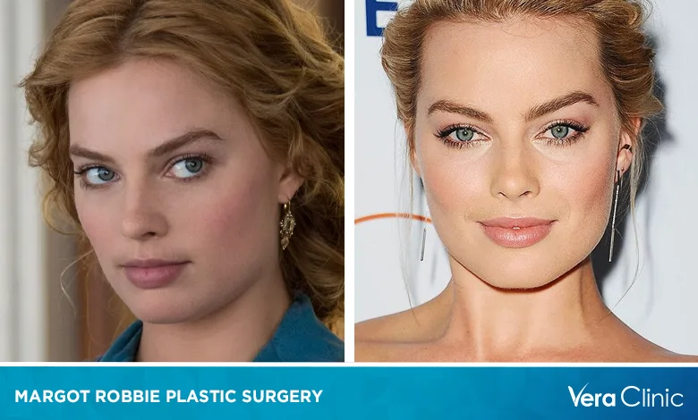 Margot Robbie Plastic Surgeries, Before and After