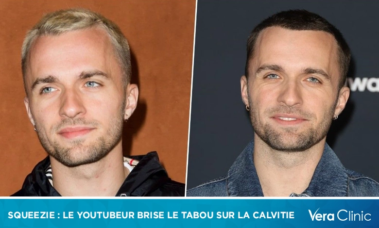 De YouTube à la Clinique : L'Aventure de Squeezie le Youtubeur avec la ...