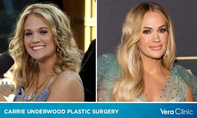 Carrie Underwood Plastic Surgeries, Before and After