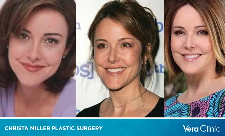 Christa Miller Plastic Surgeries, Before and After