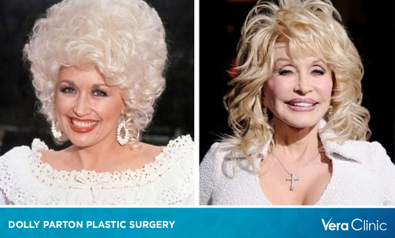Dolly Parton's Plastic Surgeries, Before and After