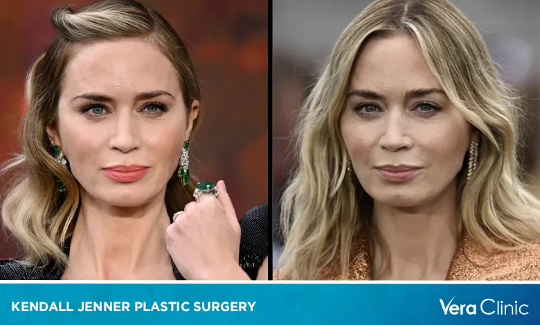 Emily Blunt Plastic Surgeries, Before and After