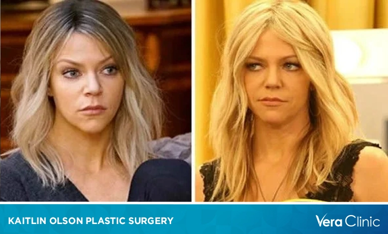 Kaitlin Olson Plastic Surgeries, Before and After