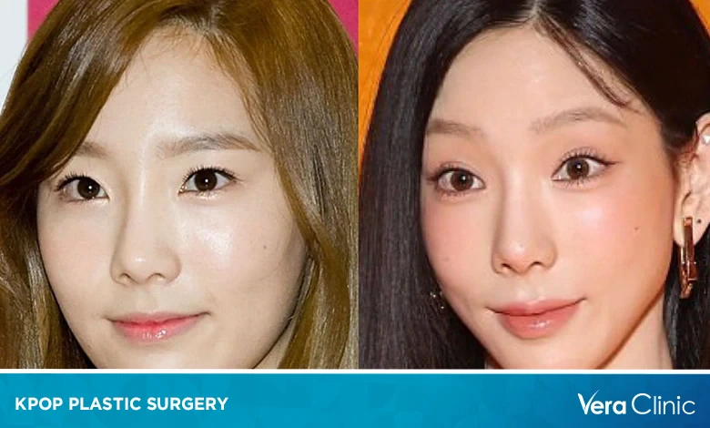 K-Pop Plastic Surgery: Unveiling the Transformations of K-Pop Idols