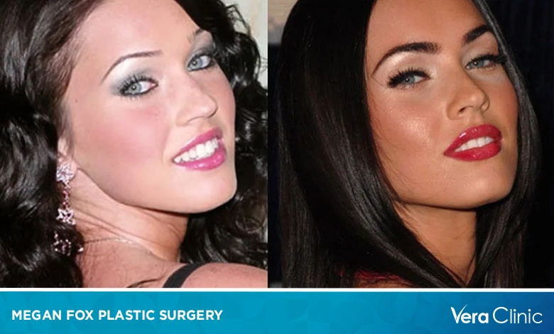 Megan Fox Plastic Surgeries, Before and After