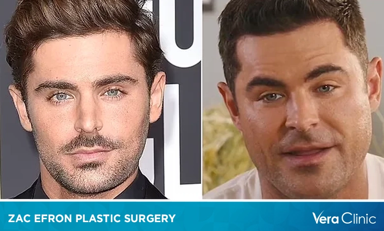 Zac Efron Plastic Surgeries, Before and After